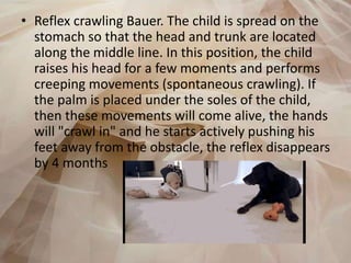 Reflexes of Newborns | PPTX