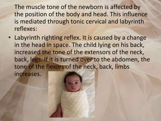 Reflexes of Newborns | PPTX