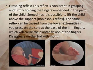 Reflexes of Newborns | PPTX