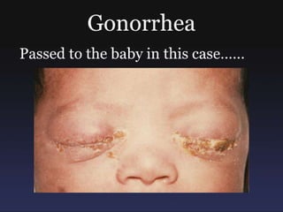 Baby think it over | PPT