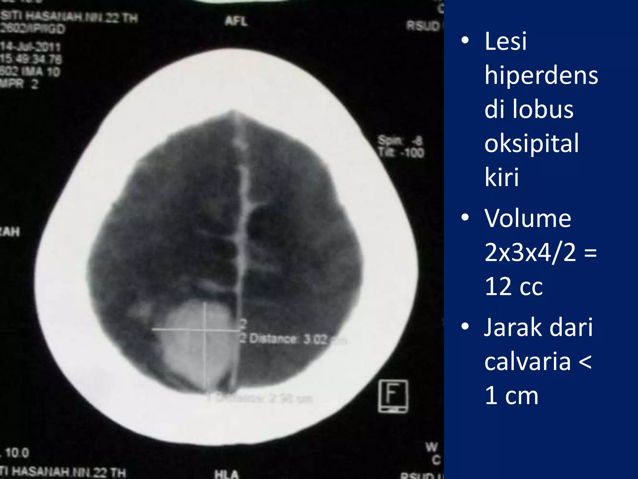Baca ct scan | PPTX