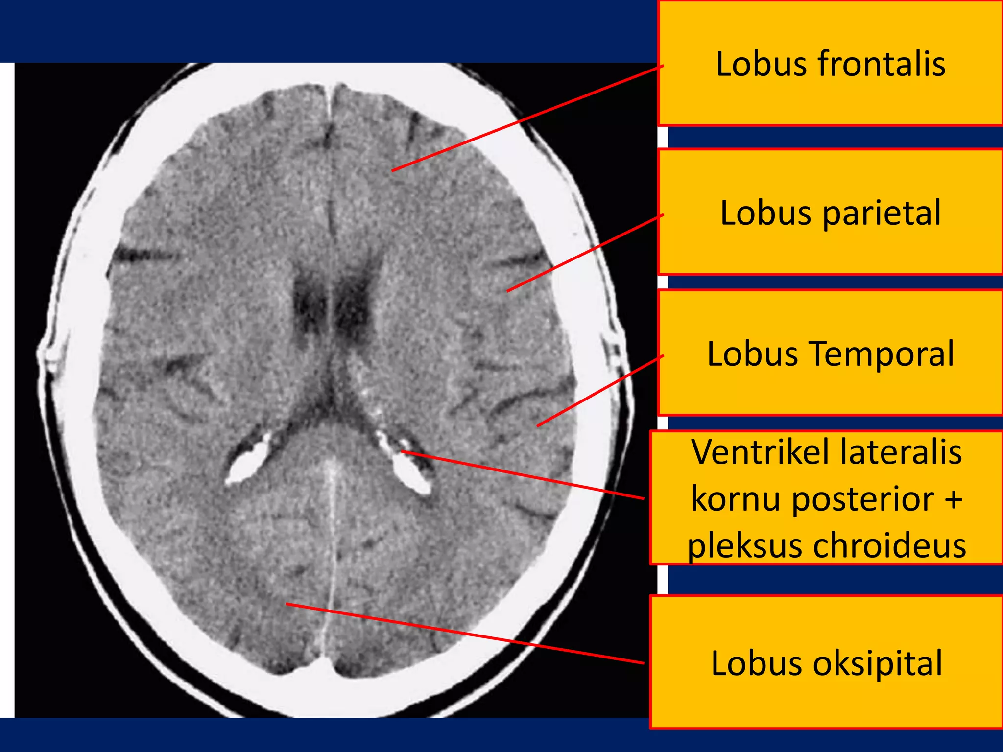 Baca ct scan | PPTX