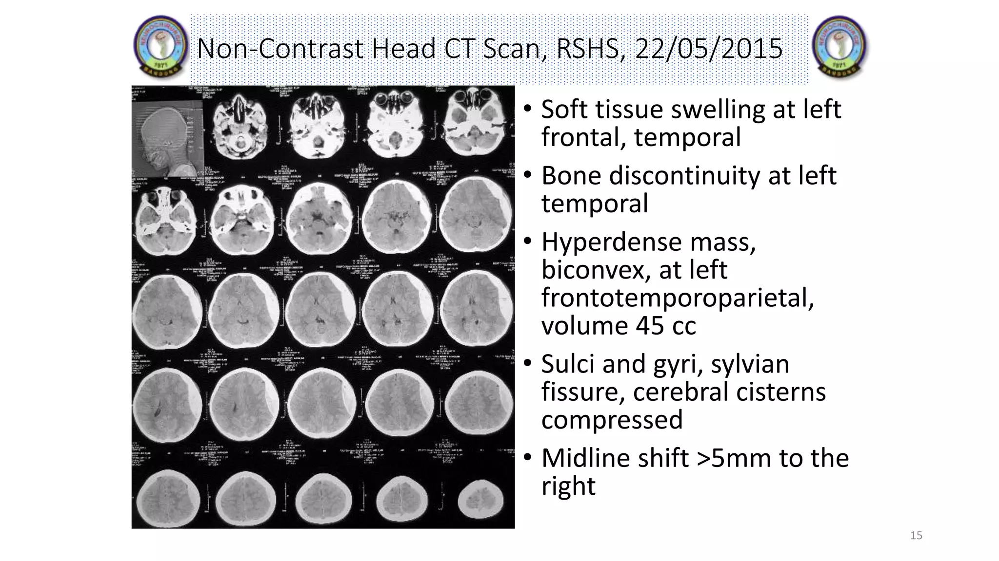 Baca CT Scan - NR (1).pptx