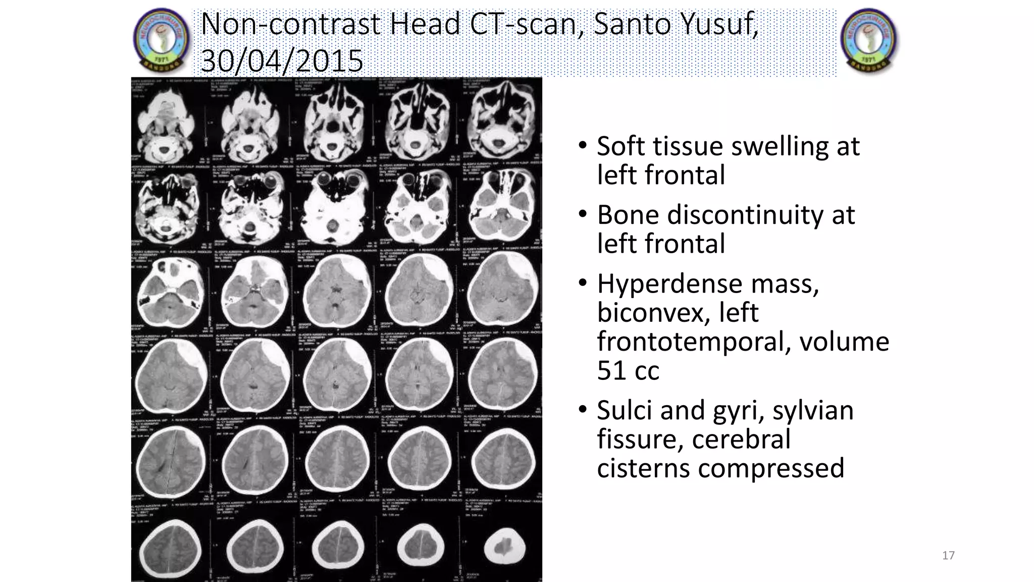 Baca CT Scan - NR (1).pptx