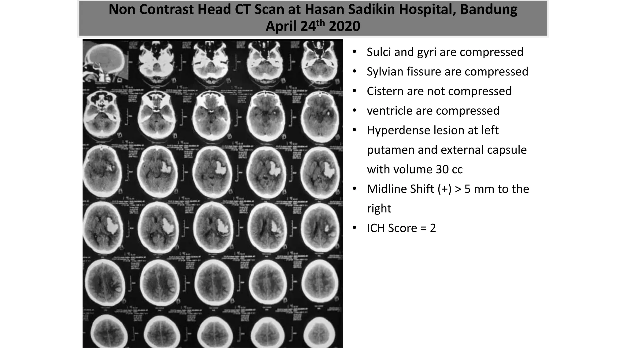 Baca CT Scan - NR (1).pptx