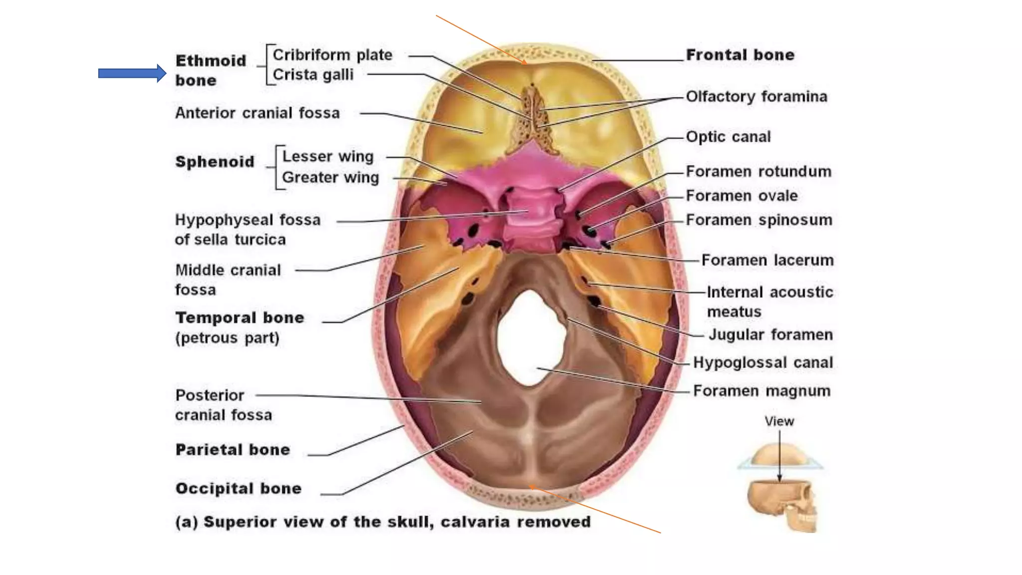 Baca CT Scan - NR (1).pptx | Death, Injury, or Military Conflict | Sensitive Topics