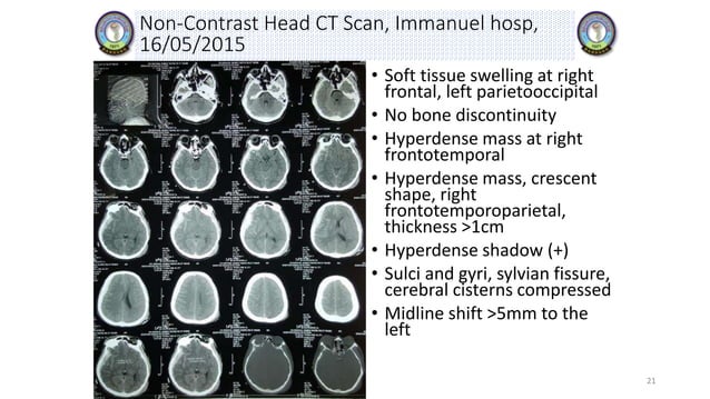 Baca CT Scan - NR (1).pptx | Death, Injury, or Military Conflict | Sensitive Topics