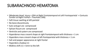 Baca CT Scan - NR (1).pptx
