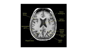 Baca CT Scan - NR (1).pptx