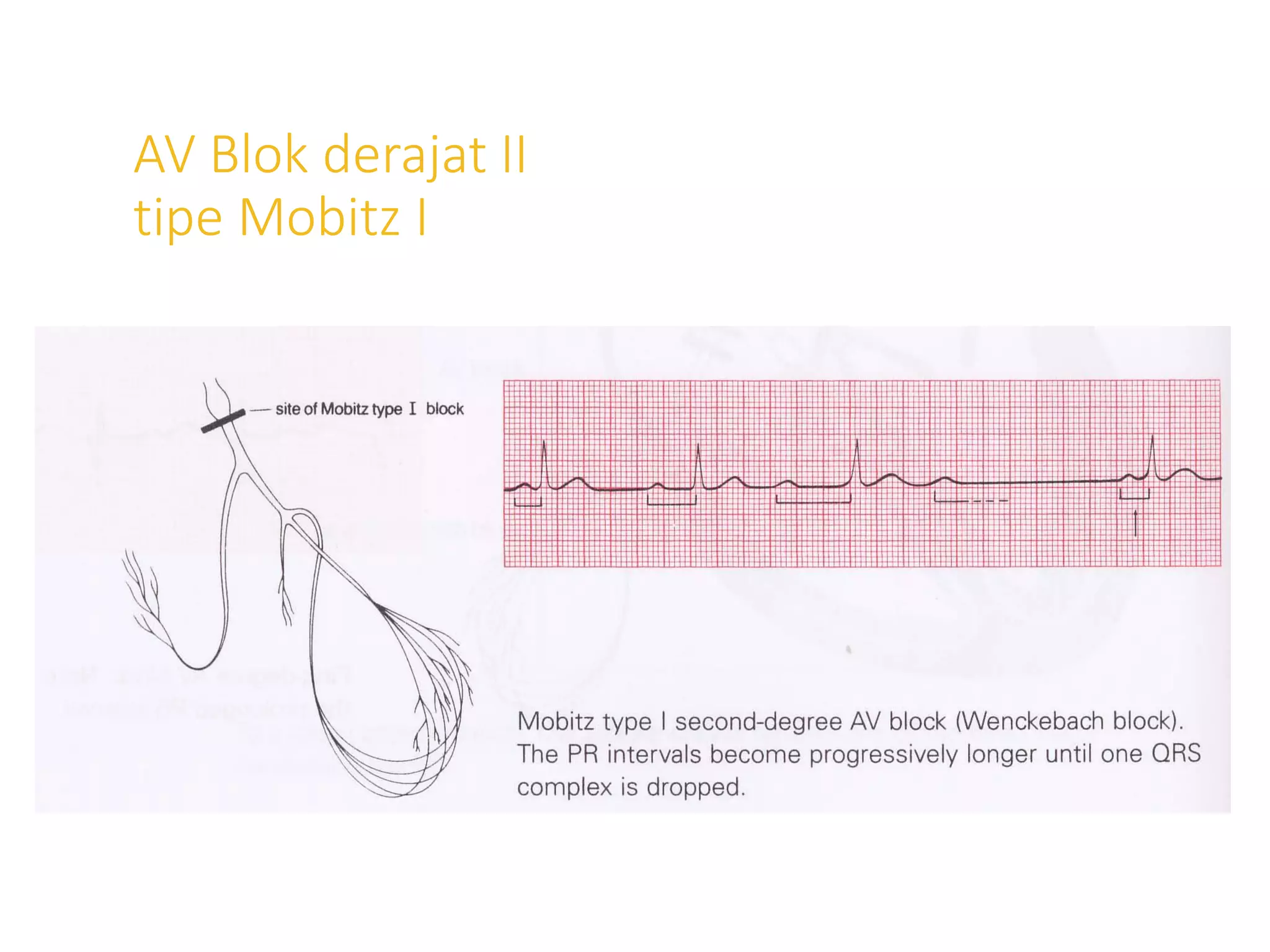 Baca EKG.pdf