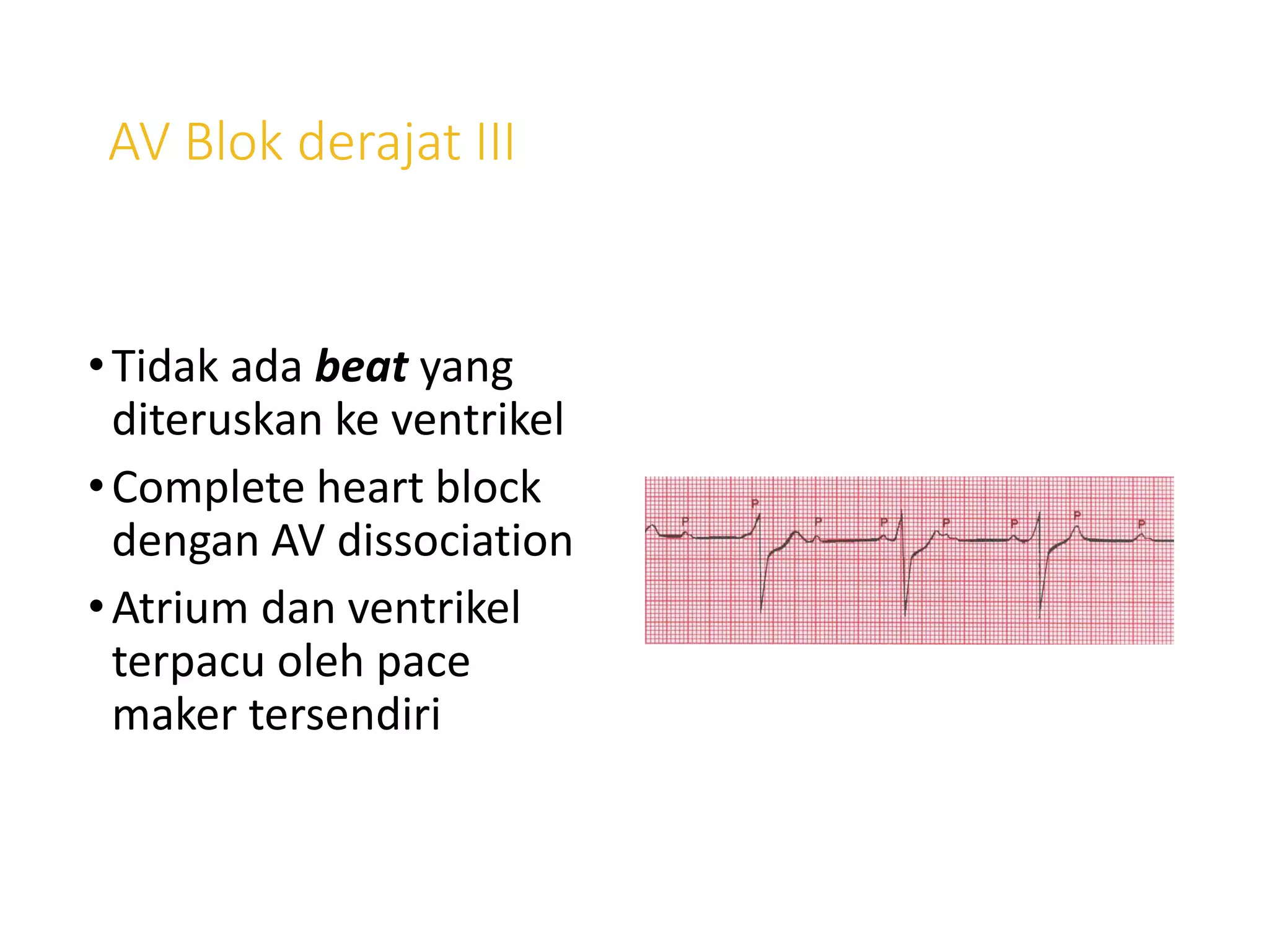 Baca EKG.pdf