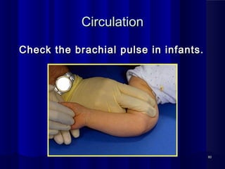 Brachial Pulse Infant