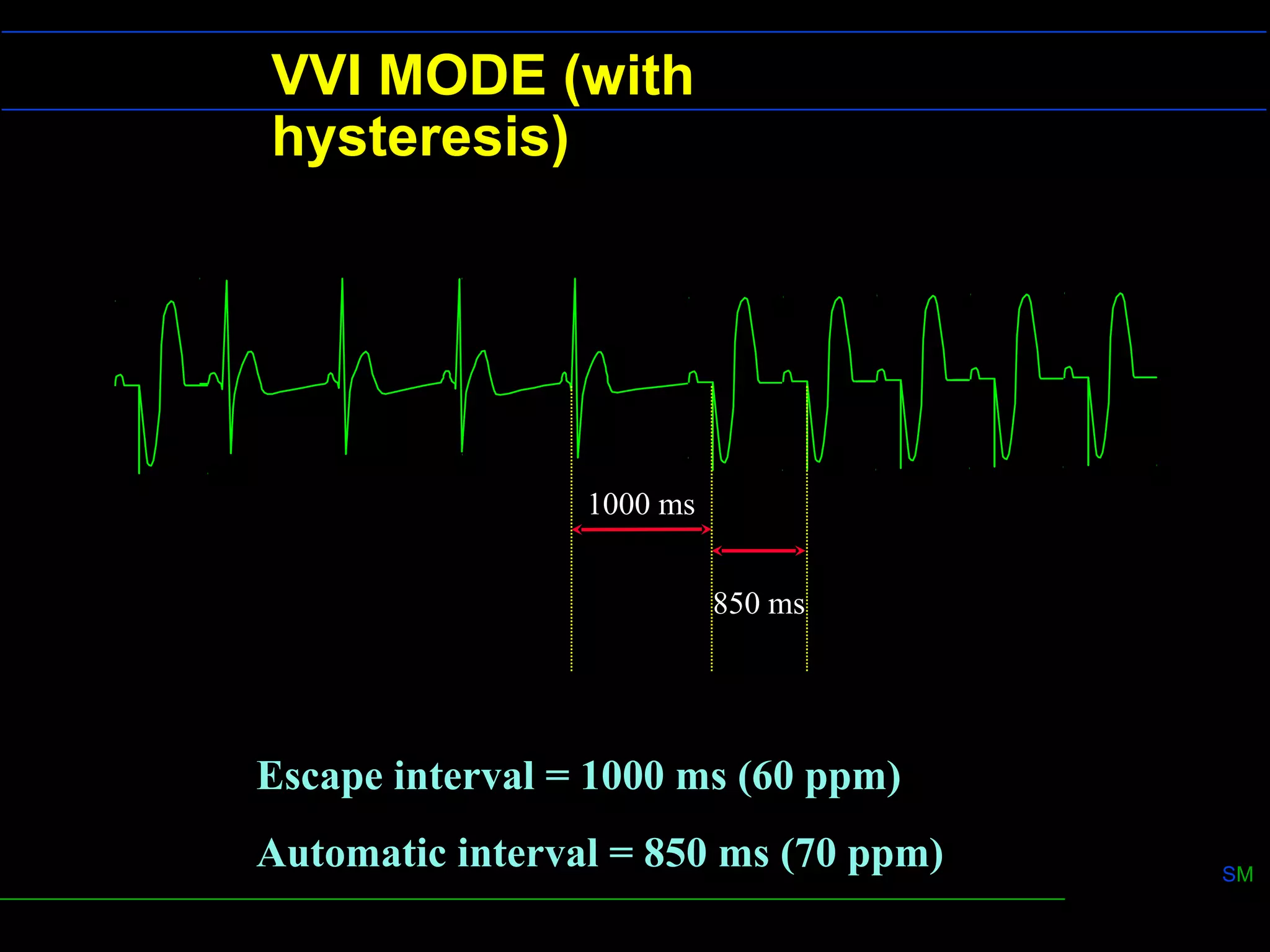 Basic Pacing Concepts | PPT