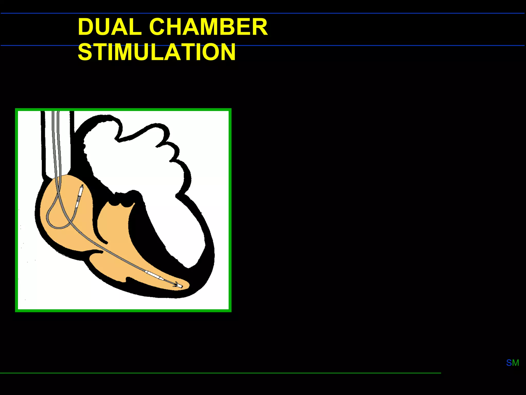 Basic Pacing Concepts | PPT