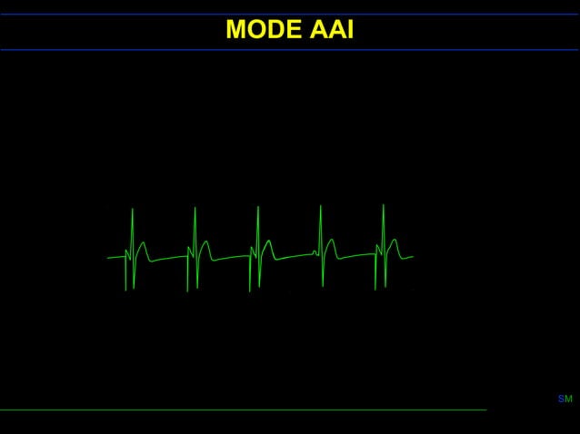 Basic Pacing Concepts | PPT