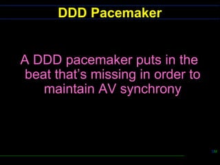 Basic Pacing Concepts | PPT