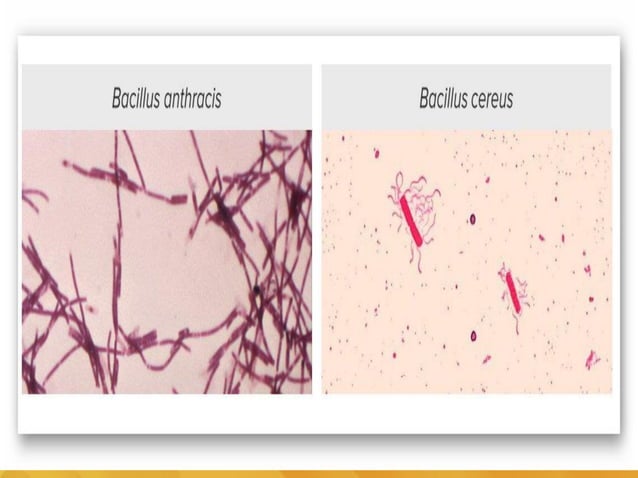 Bacillius anthracis Bacillus cereus.pdf