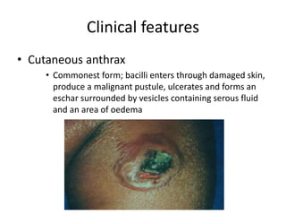 Bacillus species in medical microbiology | PPT