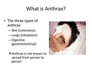 Bacillus anthracis | PPT