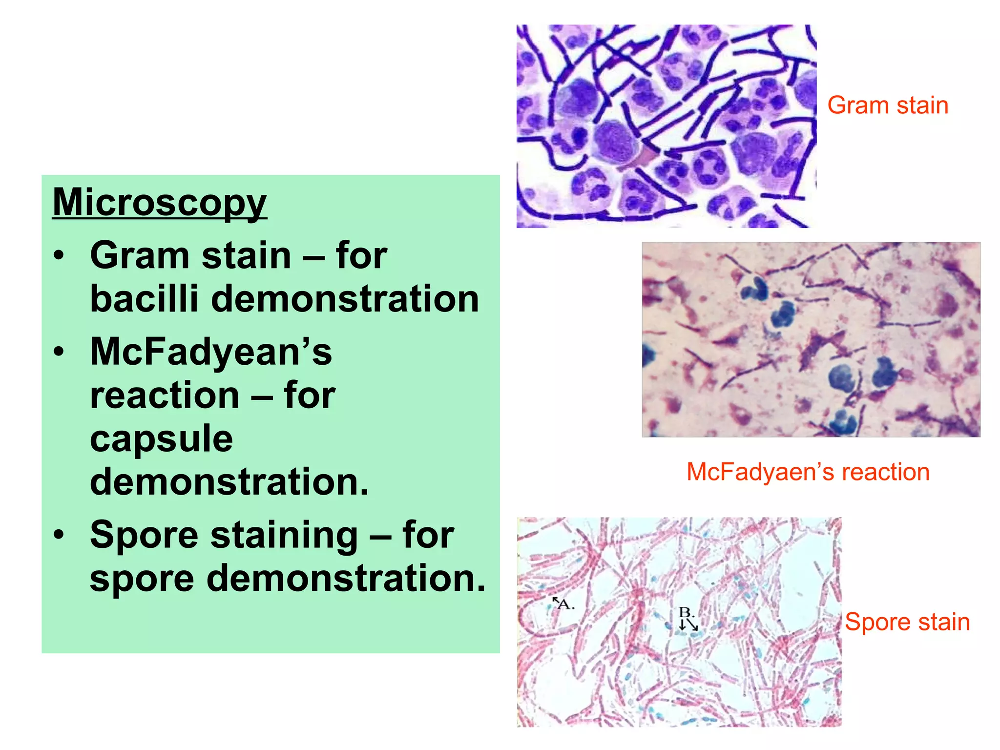 Bacillus anthracis | PPT