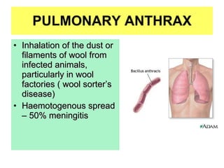 Bacillus anthracis | PPT