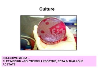 Bacillus anthracis | PPT