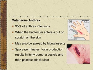 Bacillus anthracis | PPT