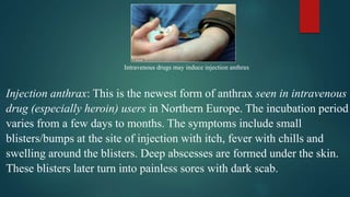 Bacillus anthracis | PPTX