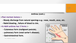Bacillus anthracis 2016 2017 original | PPTX