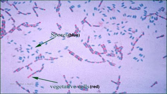 Bacillus anthracis 2016 2017 original