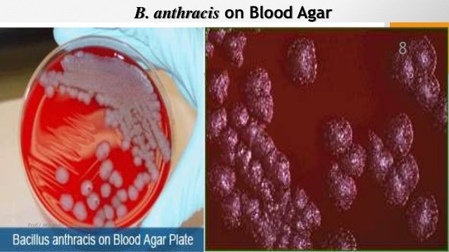 Bacillus anthracis 2016 2017 original