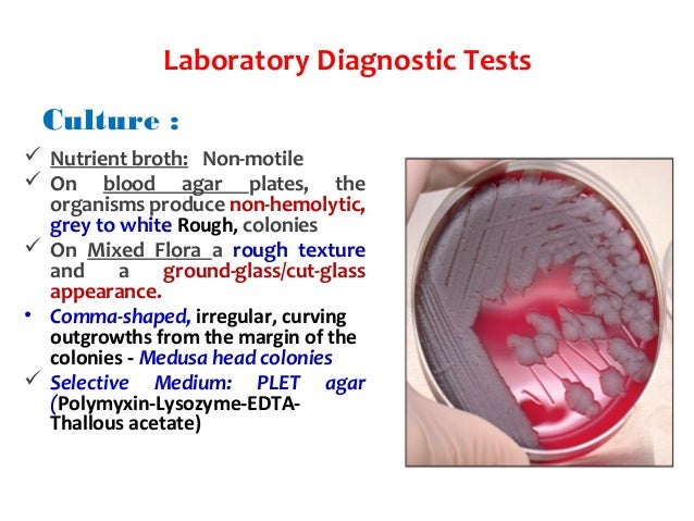 Bacillus Anthracis Toxins