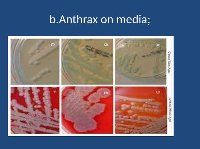 BACILLUS ANTHRAX A overview of SlideShare | PPT