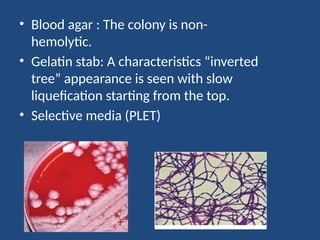 BACILLUS ANTHRAX A overview of SlideShare | PPT