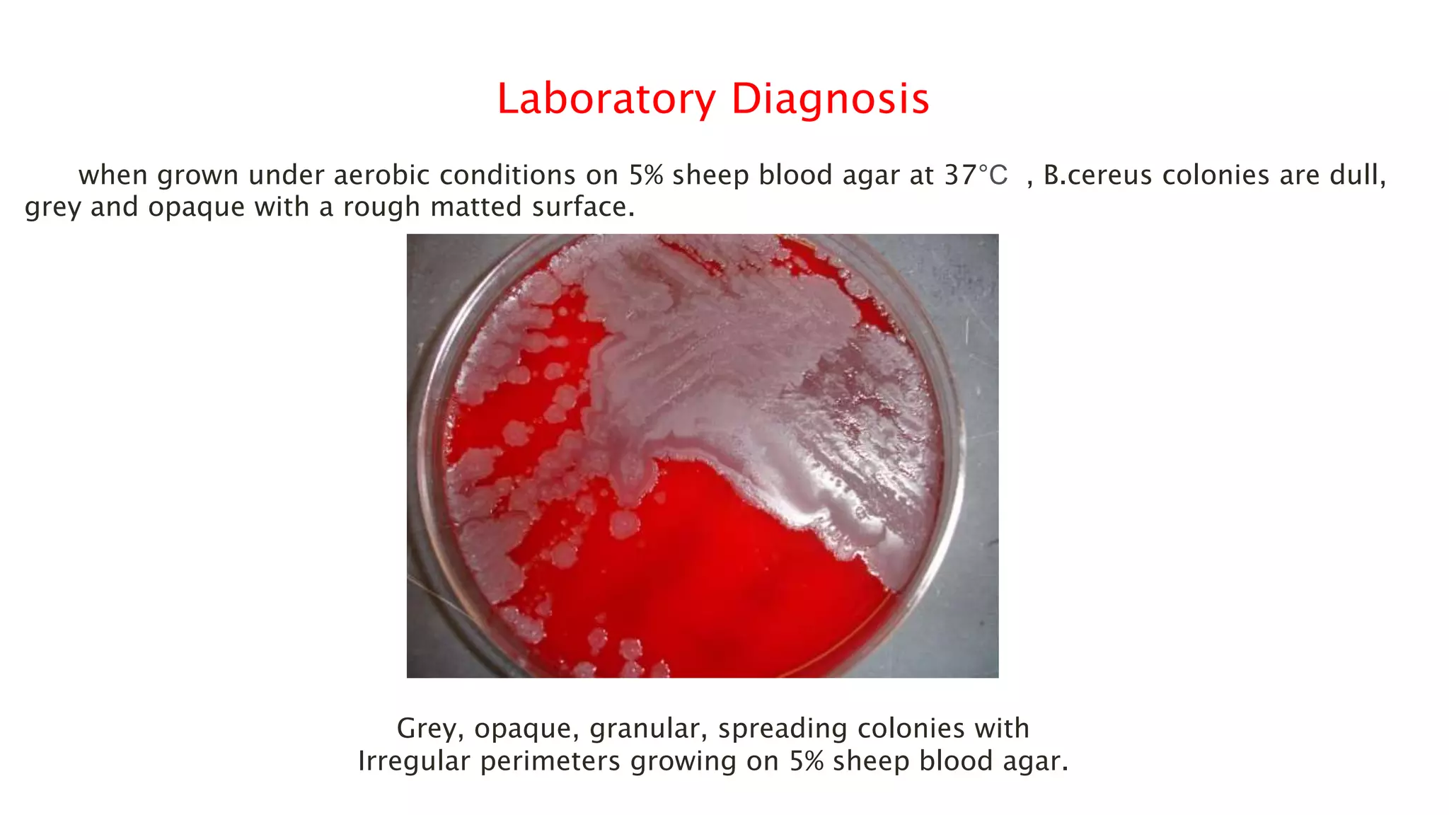 BACILLUS CEREUS.pptx