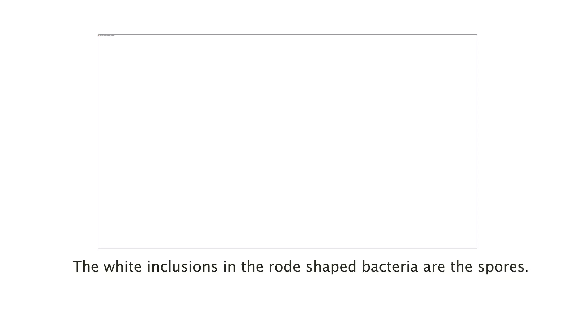 BACILLUS CEREUS.pptx