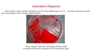 BACILLUS CEREUS.pptx