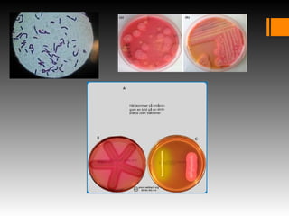 BACILLUS_CEREUS educational microbioolgy.ppt