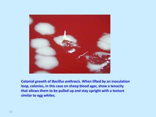 Bacillus spp..ppt....by..ali..rasool.badr