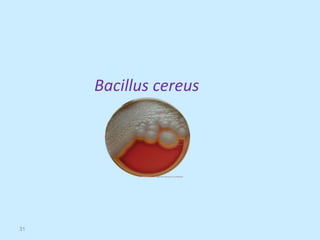 Bacillus spp..ppt....by..ali..rasool.badr