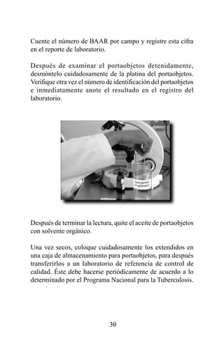 Baciloscopía directa | PDF