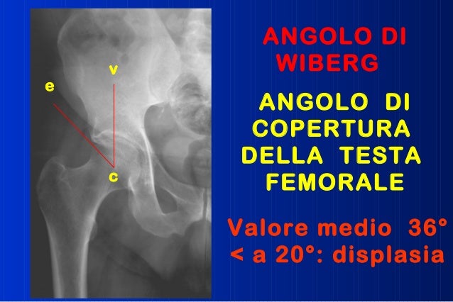 RADIOLOGIA STANDARD E PATOLOGICA DEL BACINO