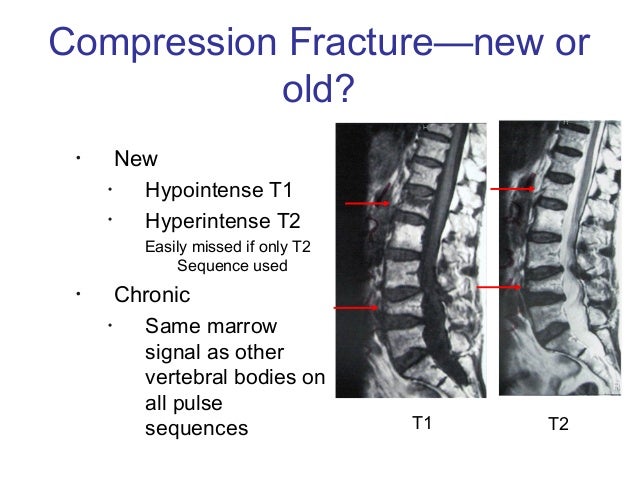 Backache imaging presentation