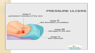 Back care in nursing | PPTX