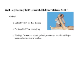 Crossed Straight Leg Raise Test