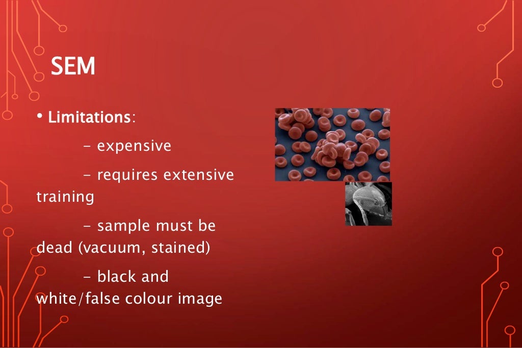 Light microscope vs. Electron microscope