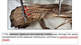 back of forearm.pptx | Death, Injury, or Military Conflict | Sensitive ...