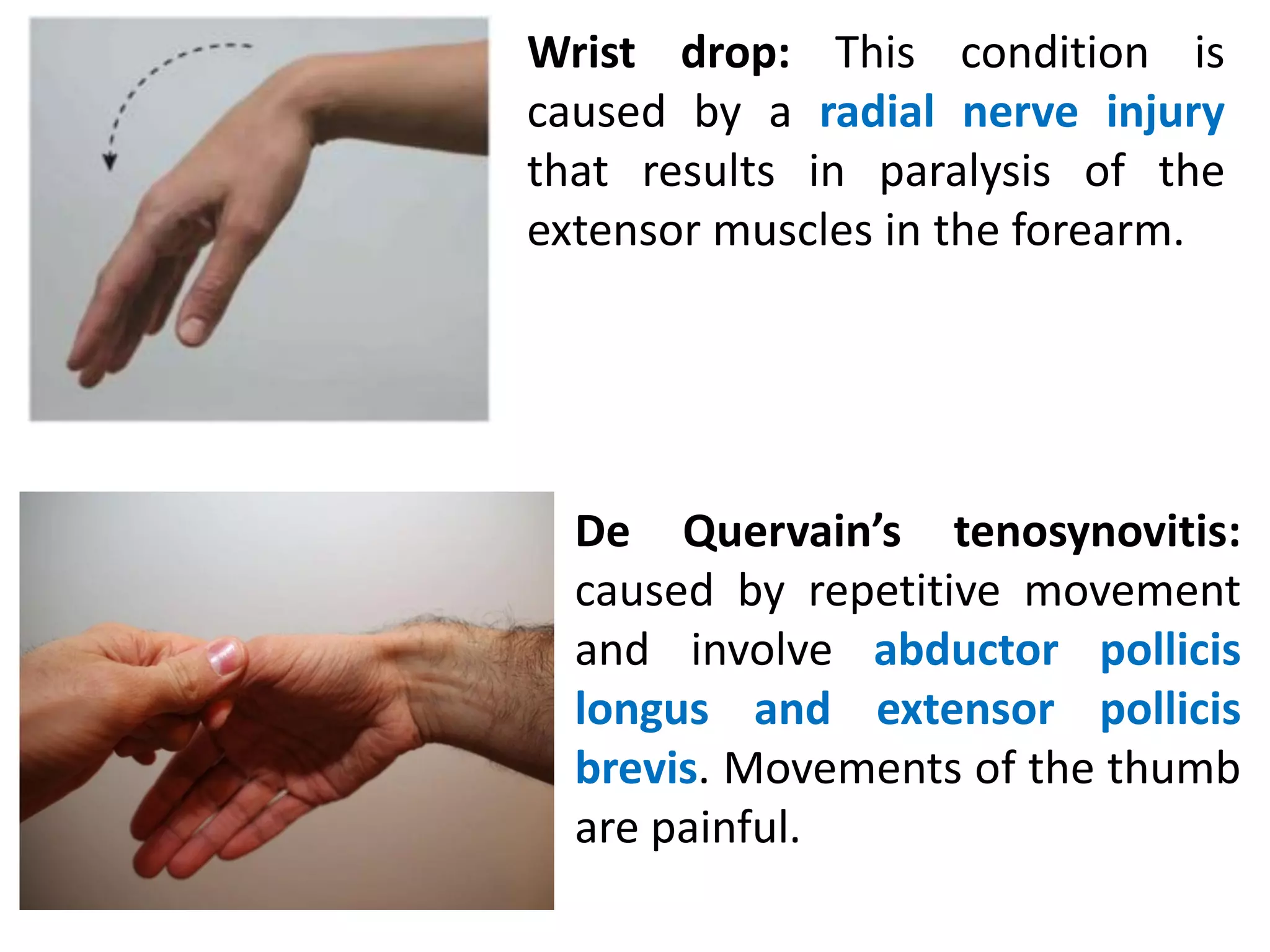 Anatomy of Back of fore arm and dorsum of hand | PDF