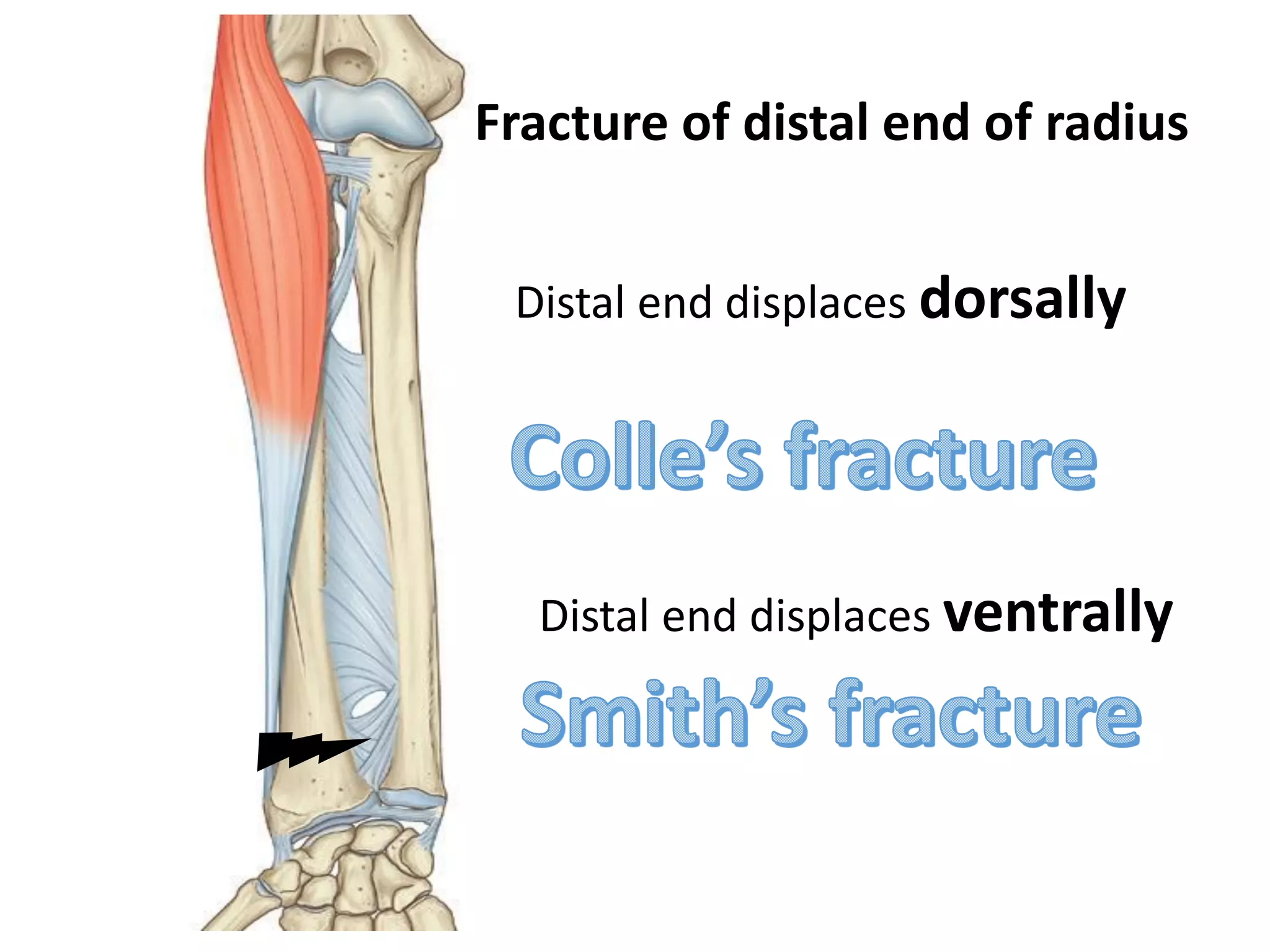 Anatomy of Back of fore arm and dorsum of hand | PDF