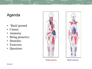 Back Pain | PPT